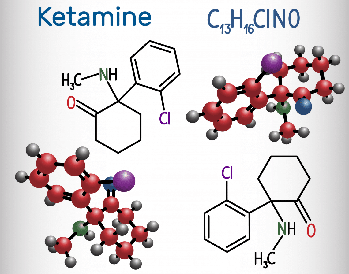 Different Types of Ketamine Treatments: Which One is Right for You ...
