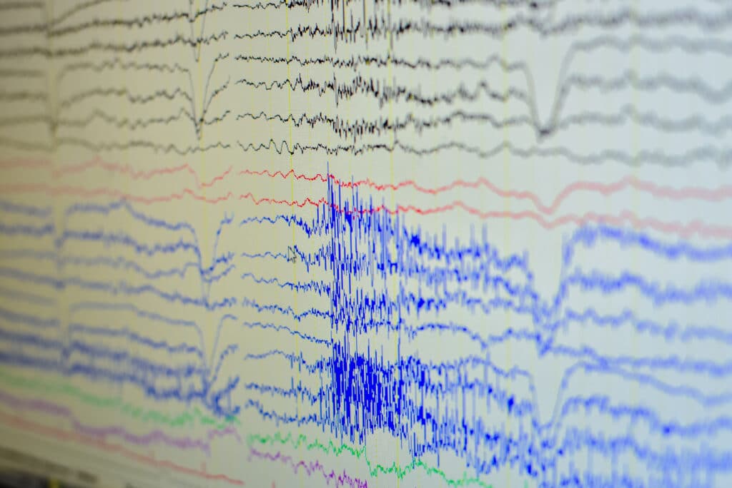 EEG Study Shows How DMT Affects Brain: Part 1 - Cannadelics